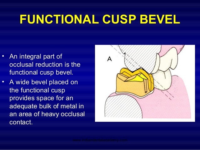 Principles of tooth preparation (2)/ orthodontic seminars