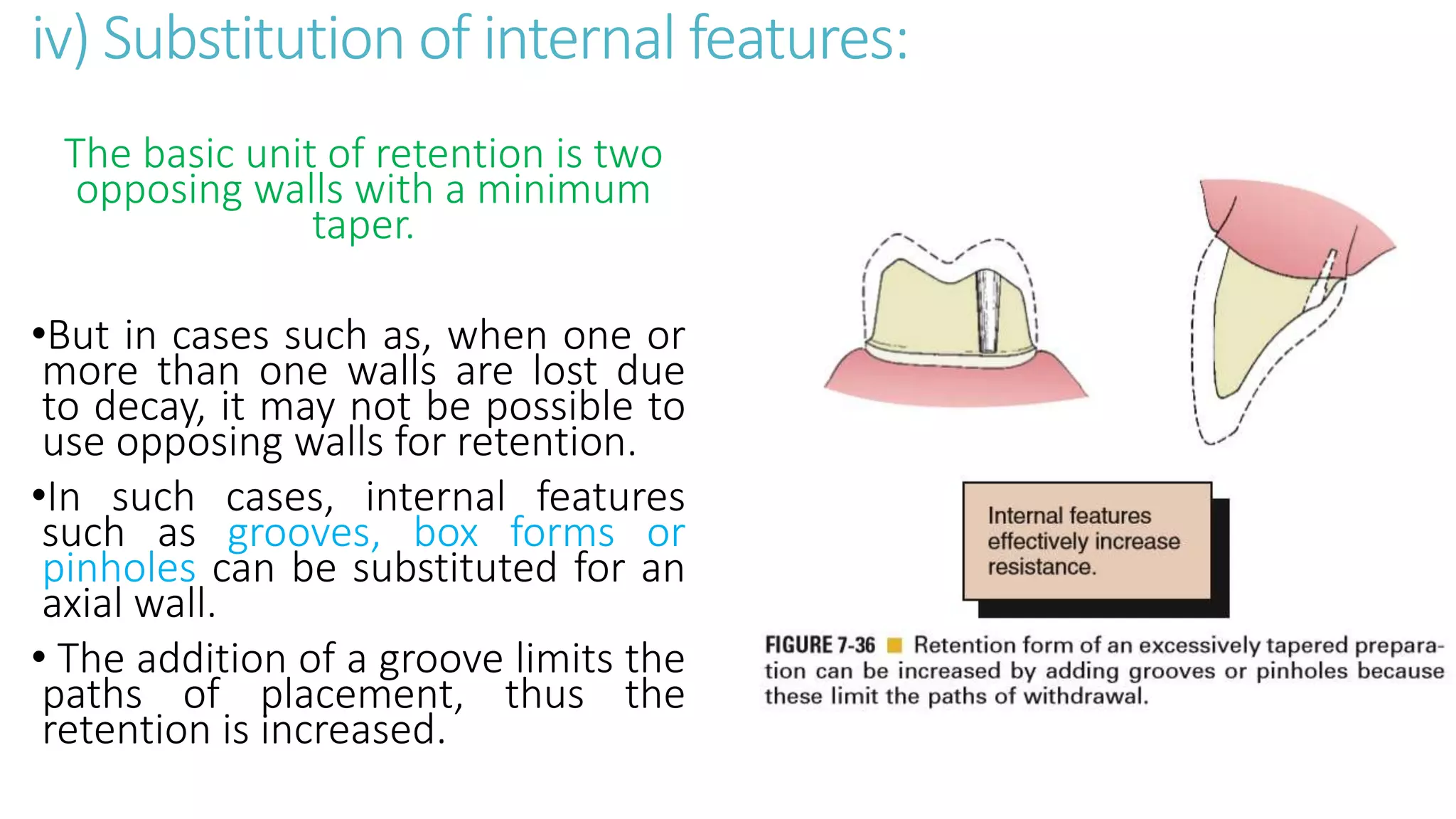 Principles of tooth preparation | PPTX