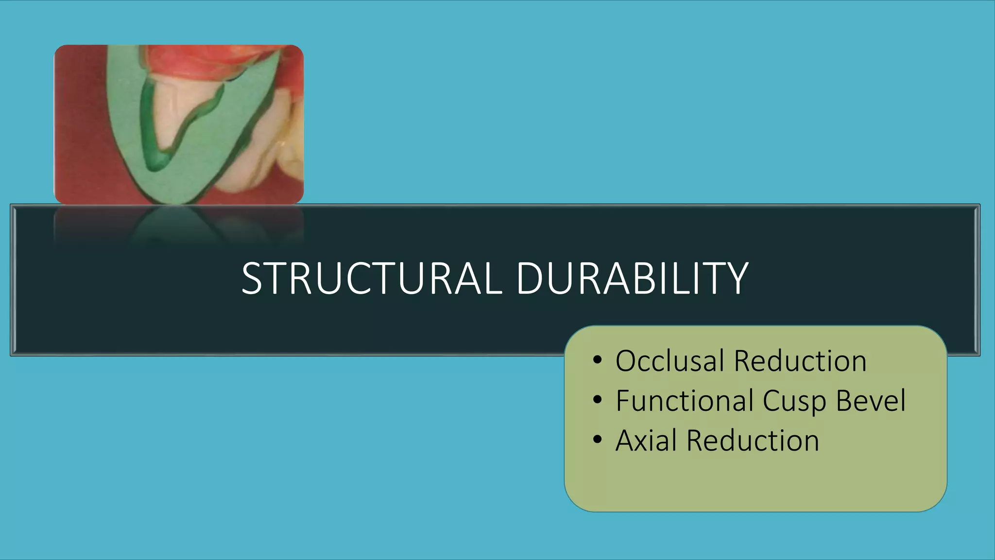 Principles of tooth preparation | PPTX