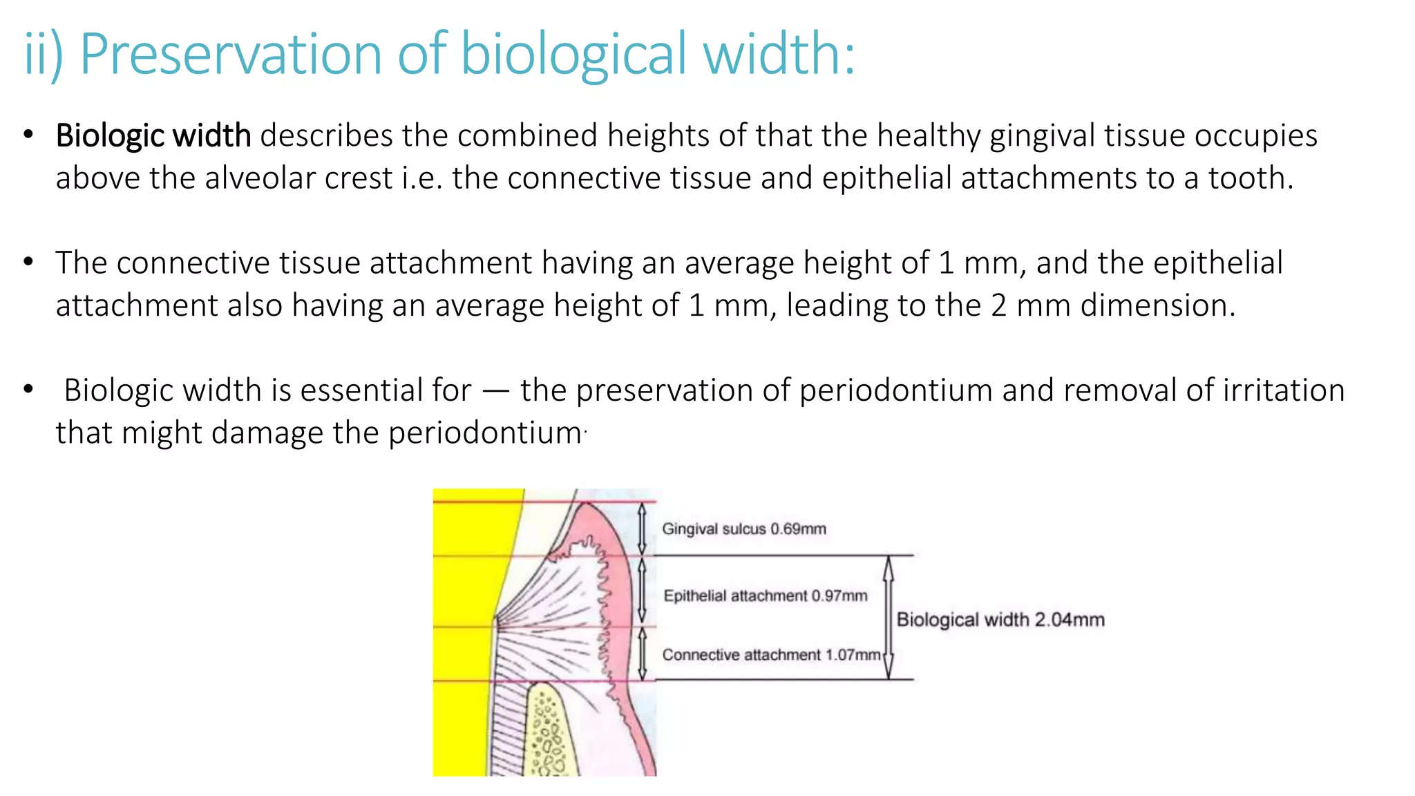 Principles of tooth preparation | PPTX