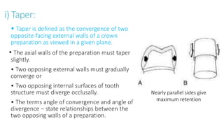 Principles of tooth preparation | PPTX