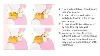 Principles of tooth preparation | PPTX