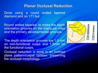 principles of tooth preperation 1.ppt Tooth | PPT
