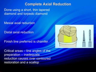 principles of tooth preperation 1.ppt Tooth | PPT