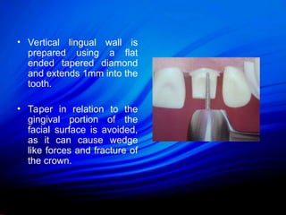principles of tooth preperation 1.ppt Tooth | PPT