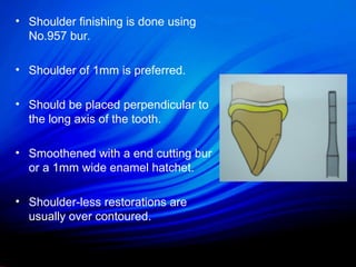 principles of tooth preperation 1.ppt Tooth | PPT