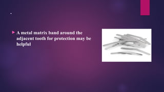 It is principles of tooth prparation.ppt