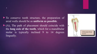 It is principles of tooth prparation.ppt