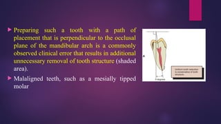 It is principles of tooth prparation.ppt
