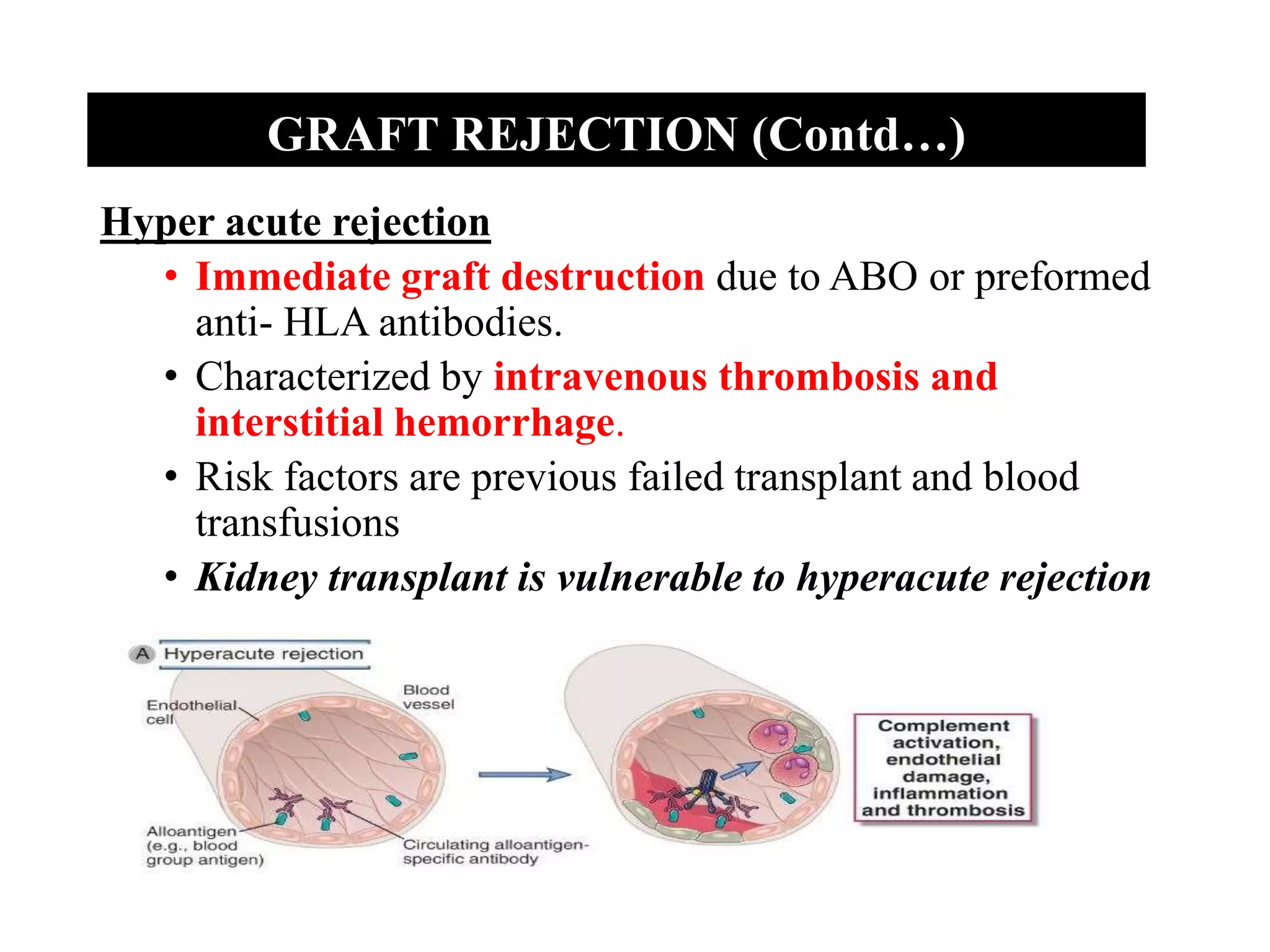 Principles of transplantation by DJ | PPTX