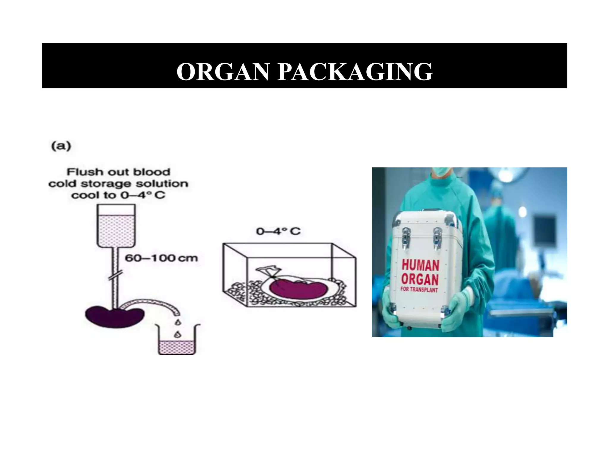 Principles of transplantation by DJ | PPTX