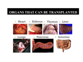 Principles of transplantation by DJ | PPTX