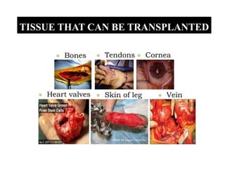 Principles of transplantation by DJ | PPTX