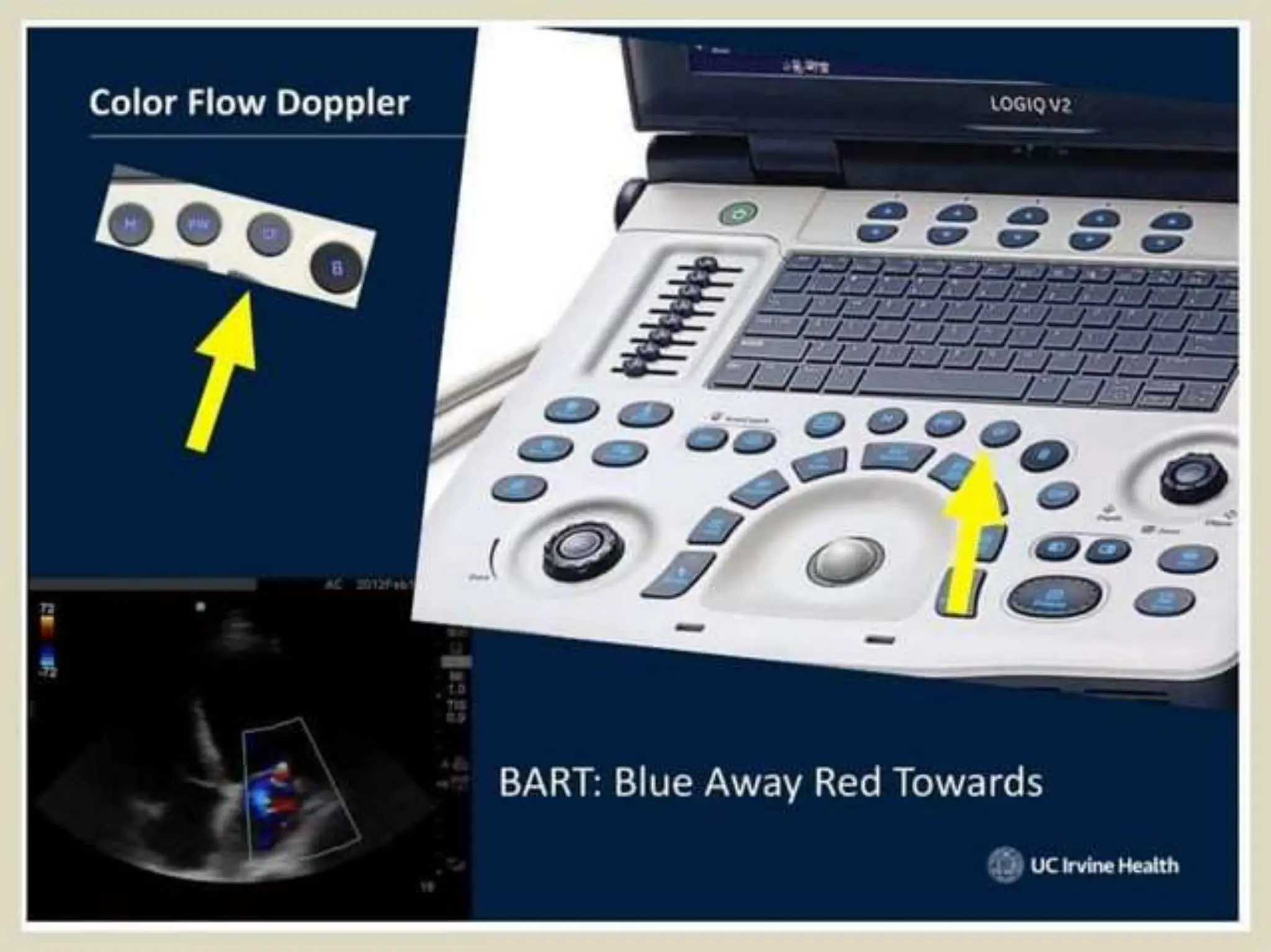 Principles Of Ultrasound-F.pptx ultrasound | PPTX