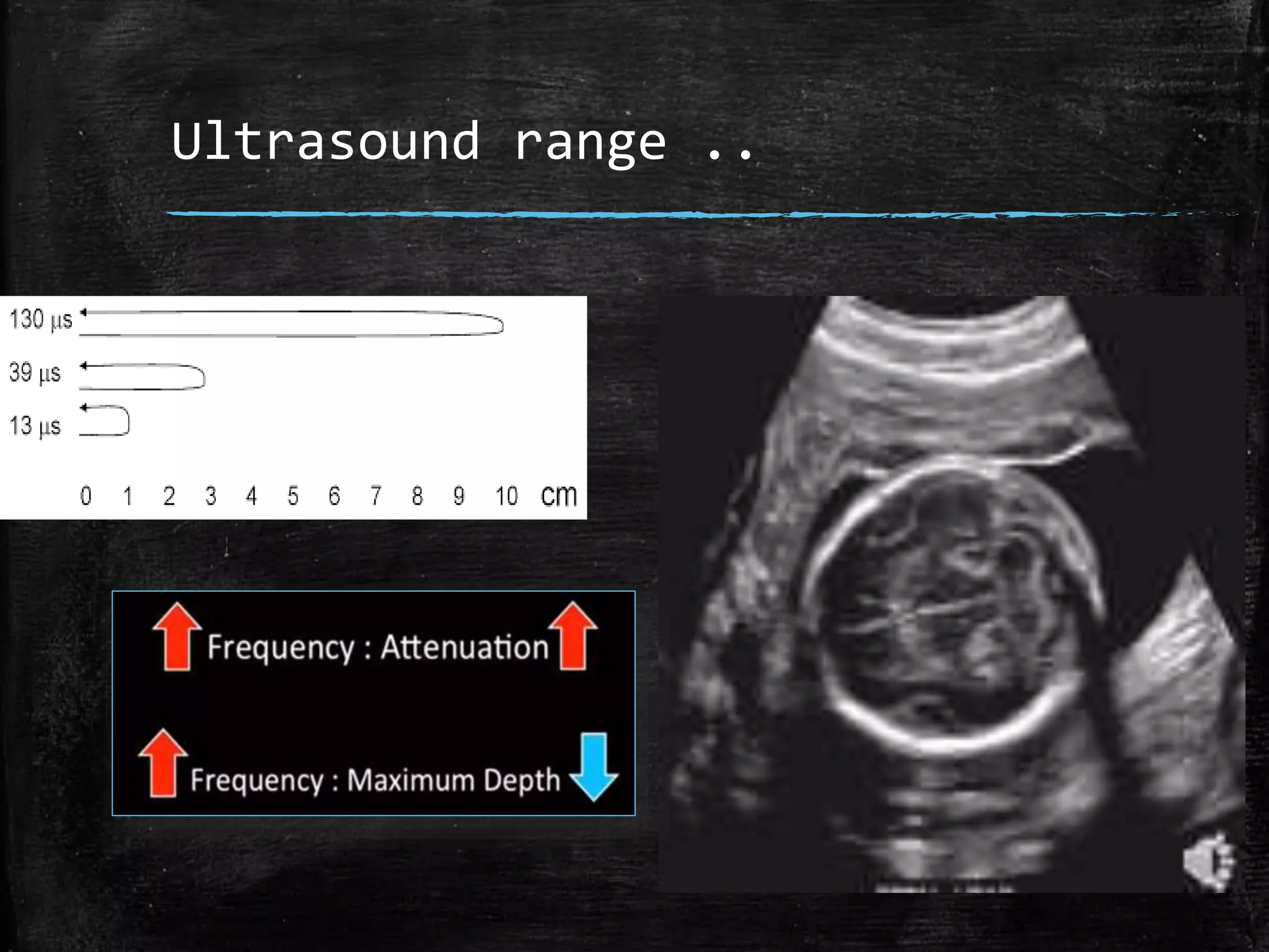 Principles of Ultrasound Physics.pptx