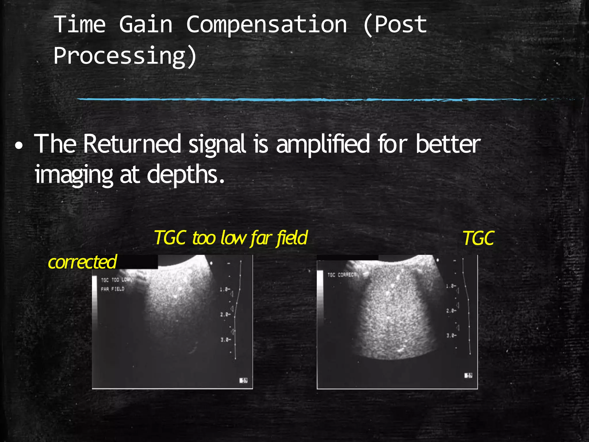 Principles Of Ultrasound Physicspptx