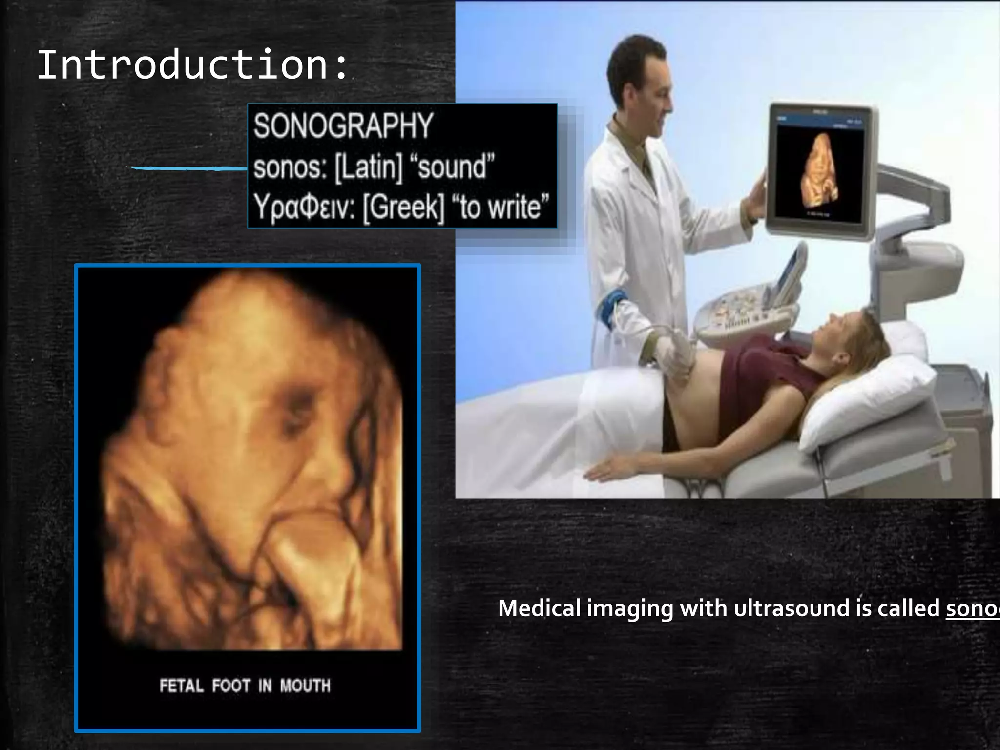 Principles of Ultrasound Physics.pptx
