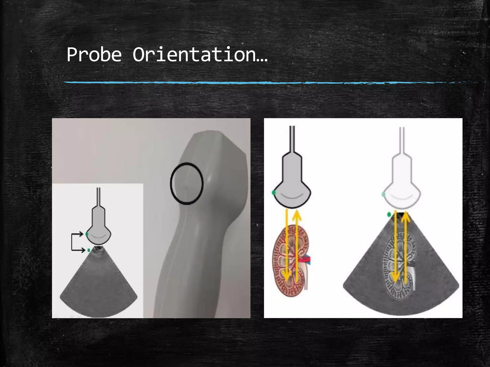 Principles of Ultrasound Physics.pptx