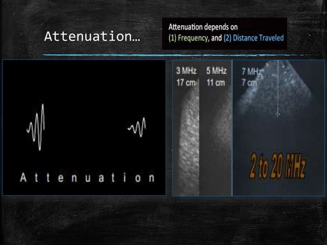Principles of Ultrasound Physics.pptx