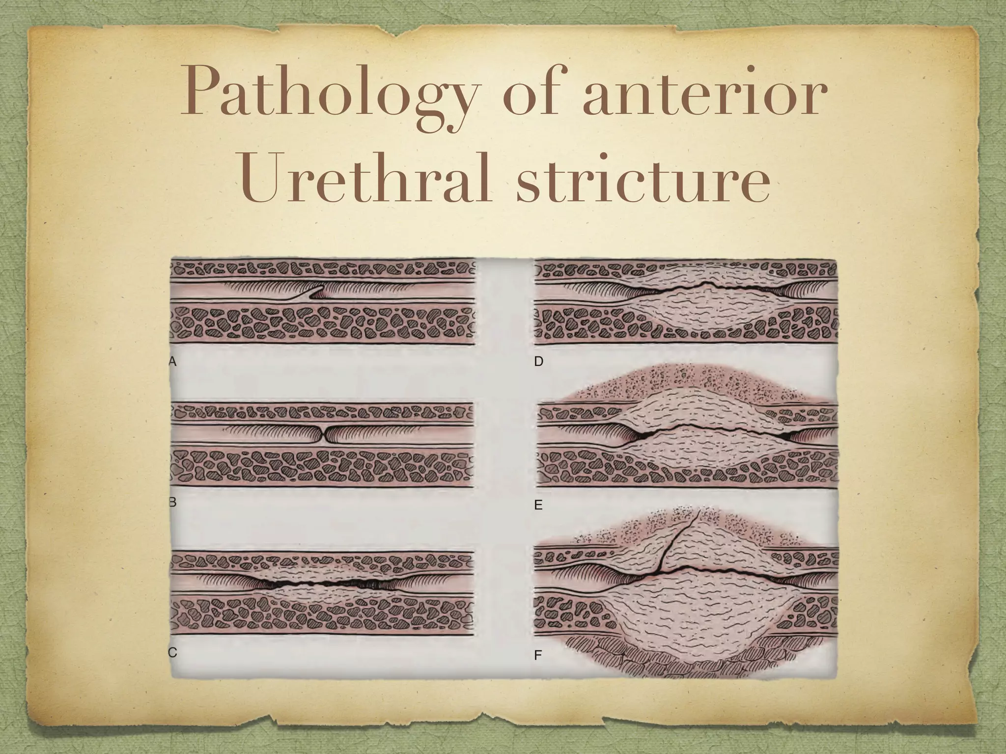 Principles of urethral reconstructive surgery | PDF