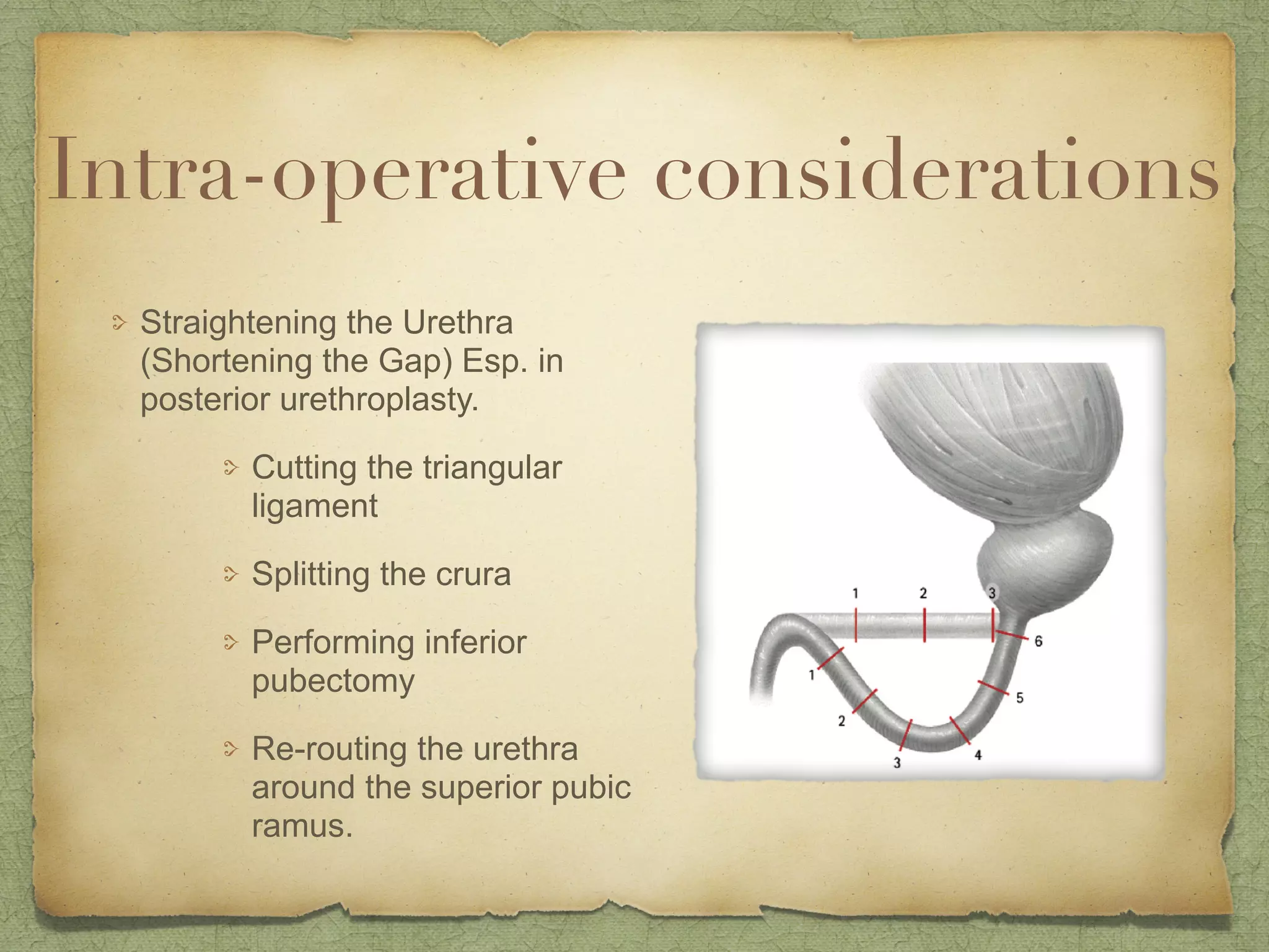 Principles of urethral reconstructive surgery | PDF