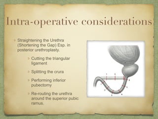 Principles of urethral reconstructive surgery | PPT