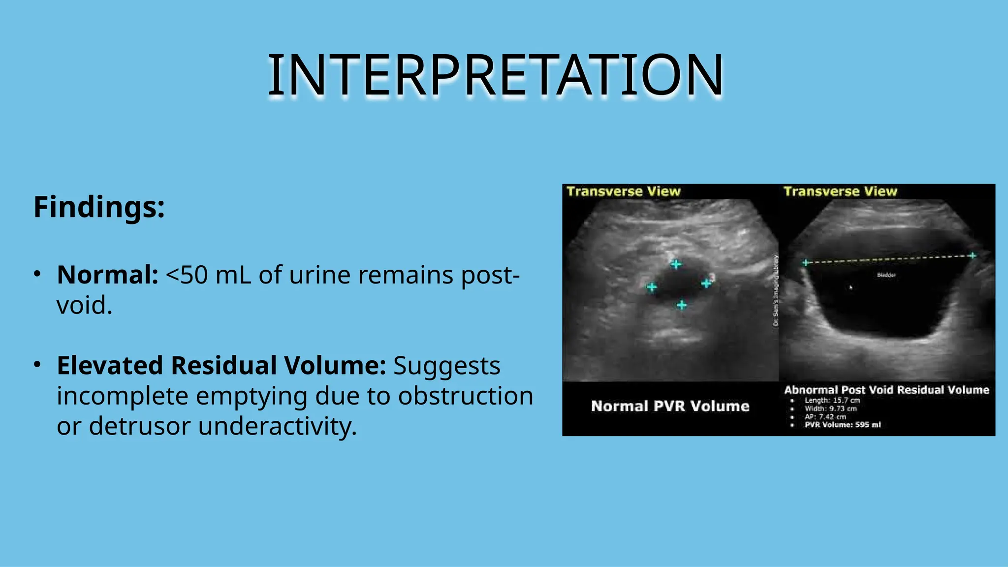 Principles of Urodynamics in urology.pptx