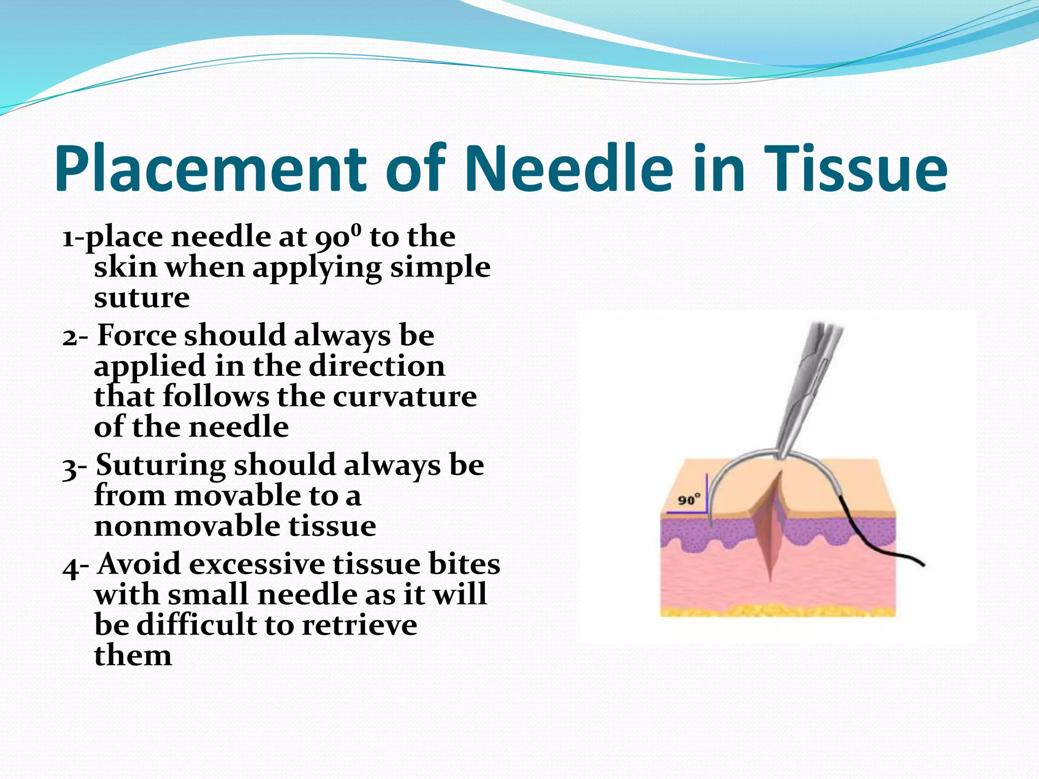 Principles of use and abuse of suture 1 | PPTX