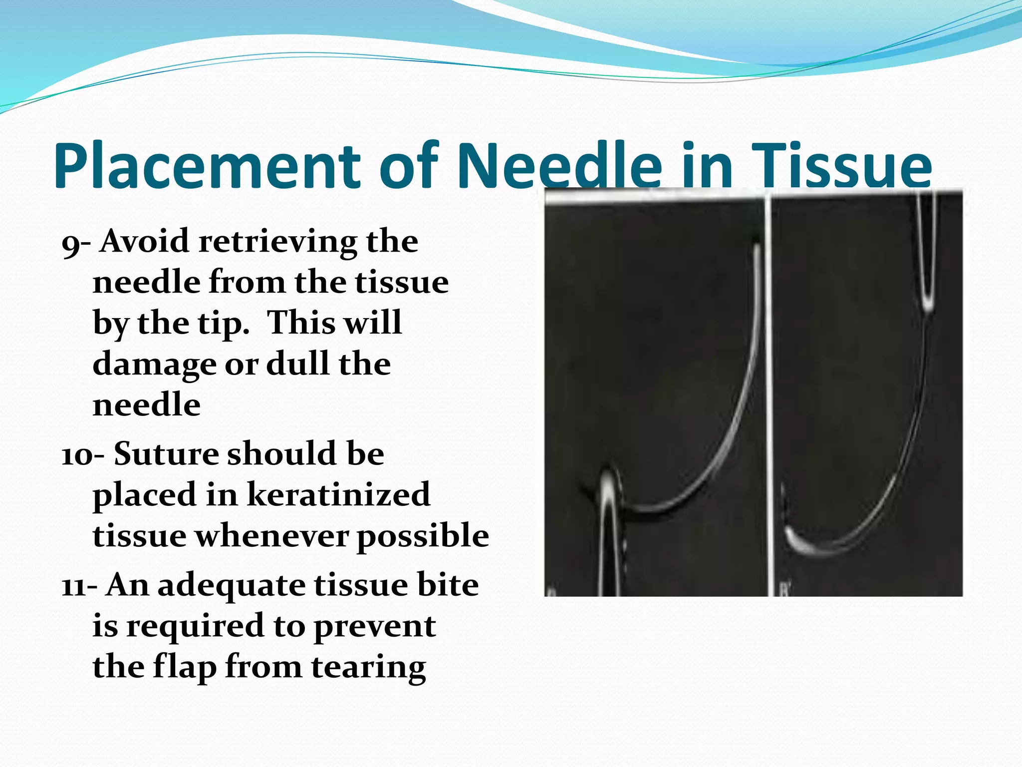 Principles of use and abuse of suture 1 | PPT