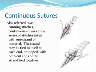 Principles of use and abuse of suture 1 | PPTX