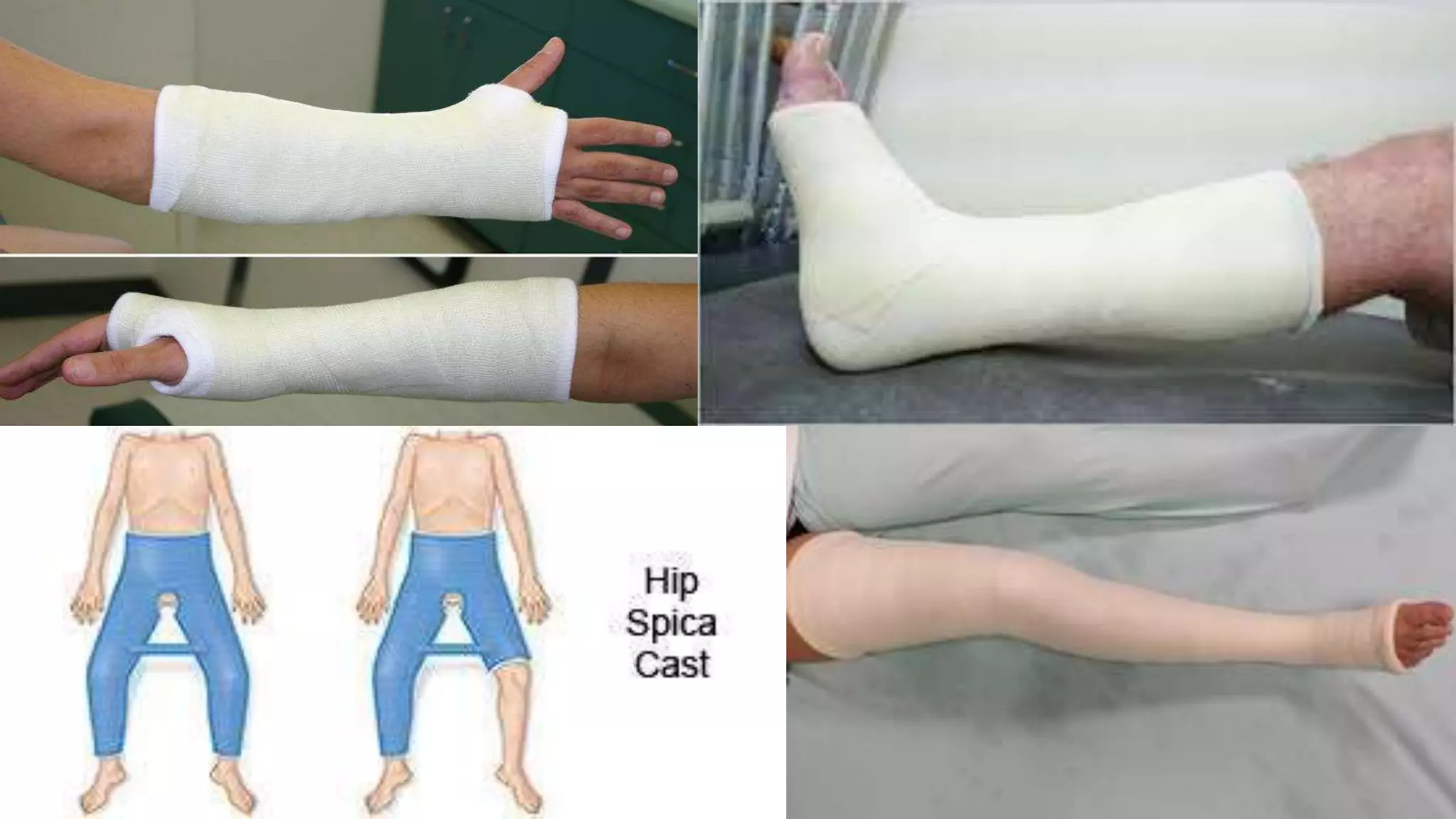 Principles of POP Casting | PPTX