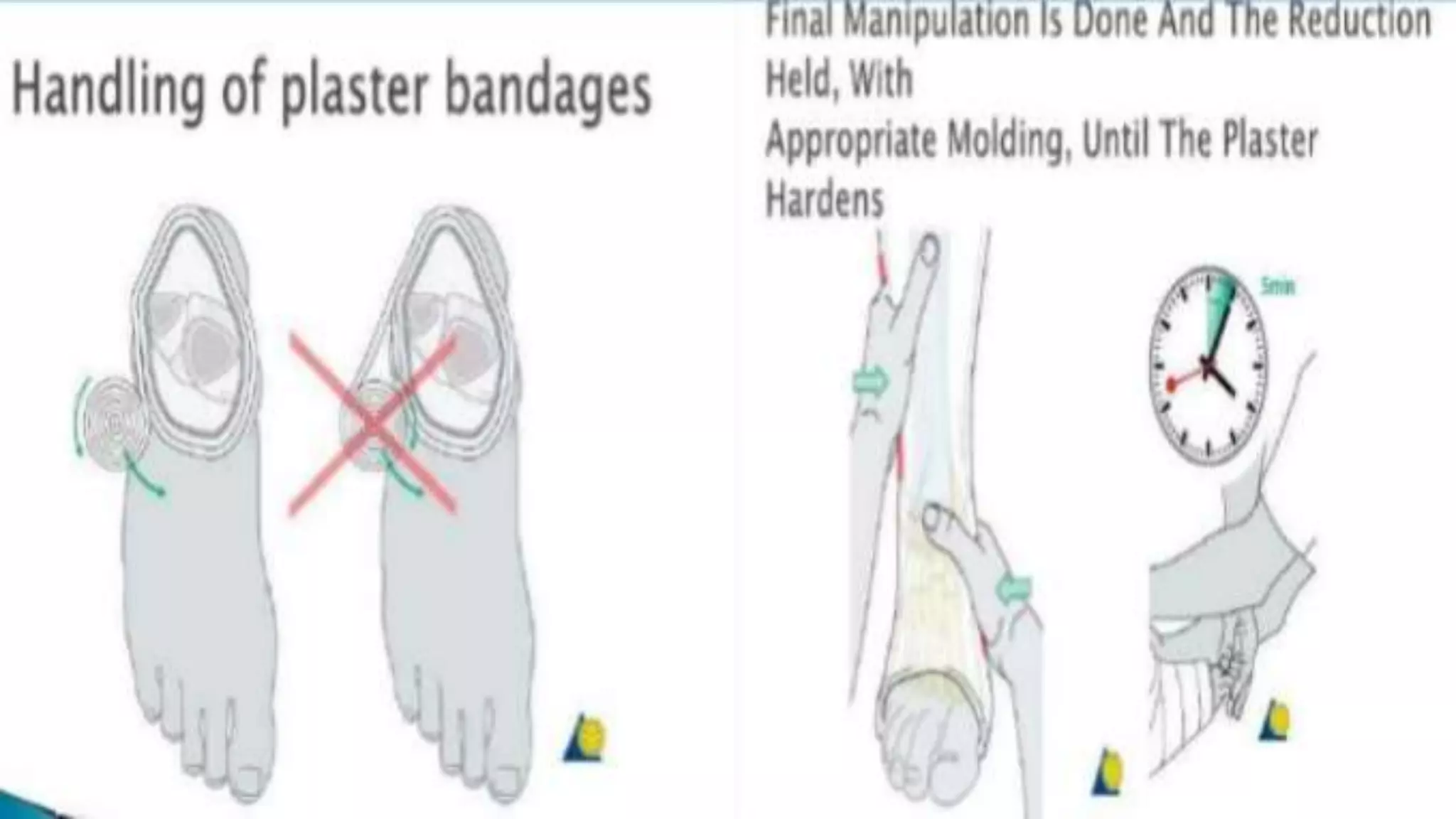 Principles of POP Casting | PPTX
