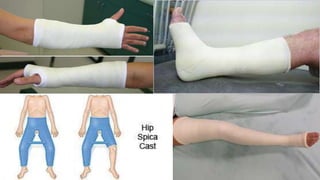 Principles of POP Casting | PPTX