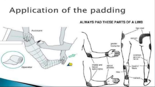 Principles of POP Casting | PPTX