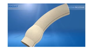Principles of Valve Sparing Procedure [Autosaved].pptx
