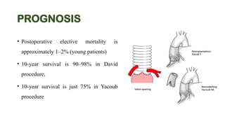 Principles of Valve Sparing Procedure [Autosaved].pptx