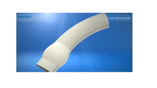 Principles of Valve Sparing Procedure [Autosaved].pptx
