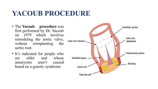 Principles of Valve Sparing Procedure [Autosaved].pptx