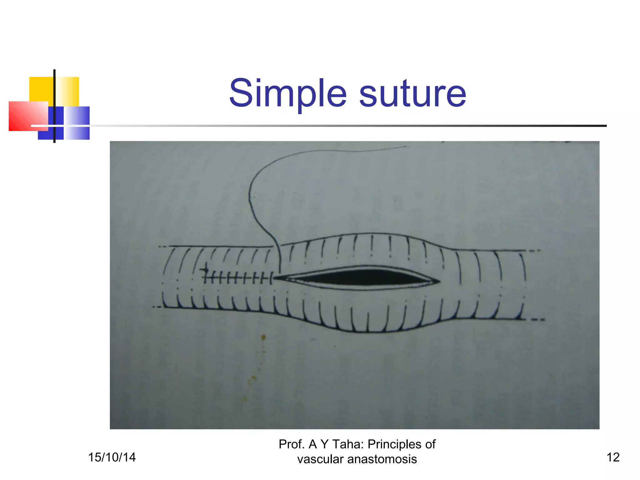 Principles of vascular anastomosis | PPT