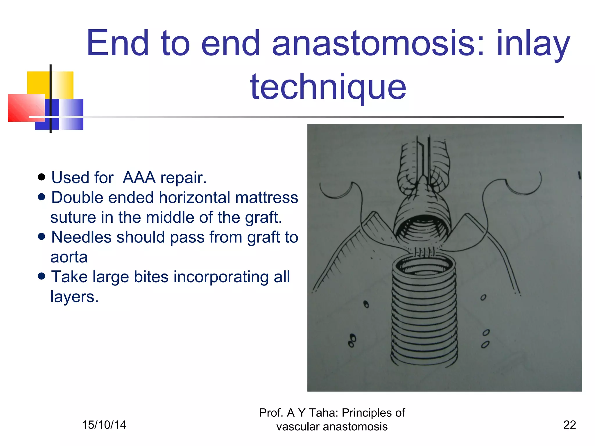 Principles of vascular anastomosis | PPT