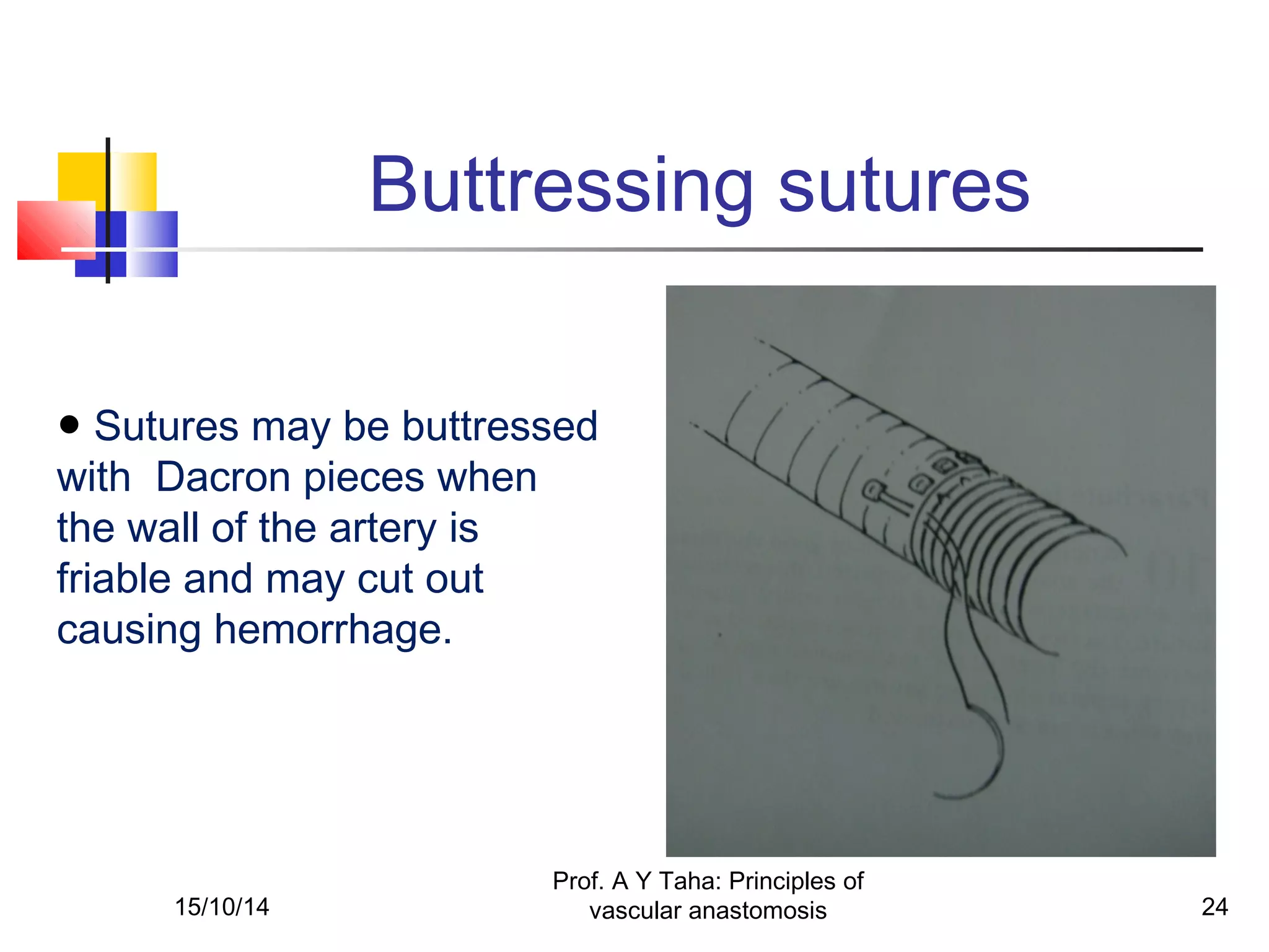 Principles of vascular anastomosis | PPT