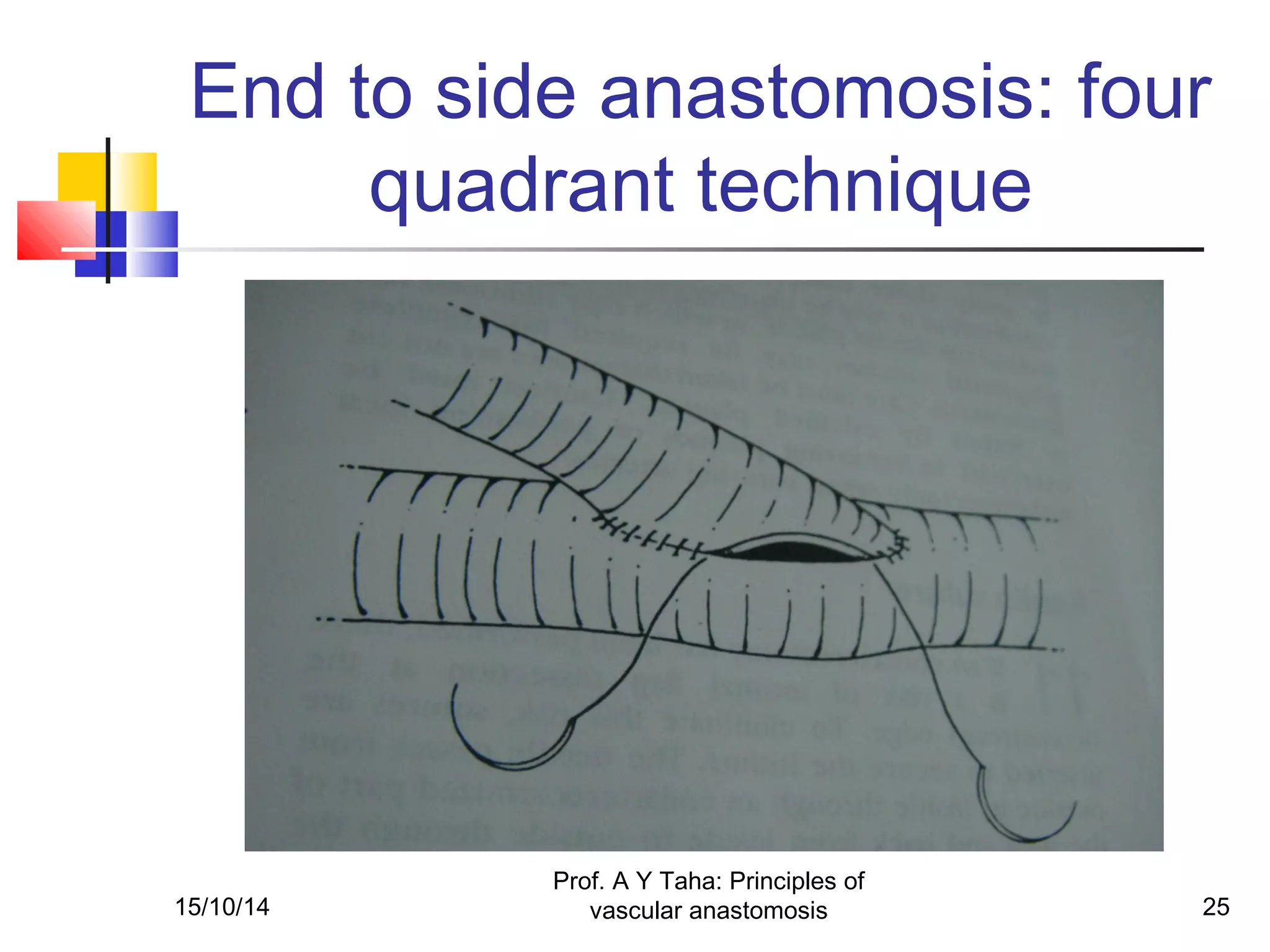 Principles of vascular anastomosis | PPT