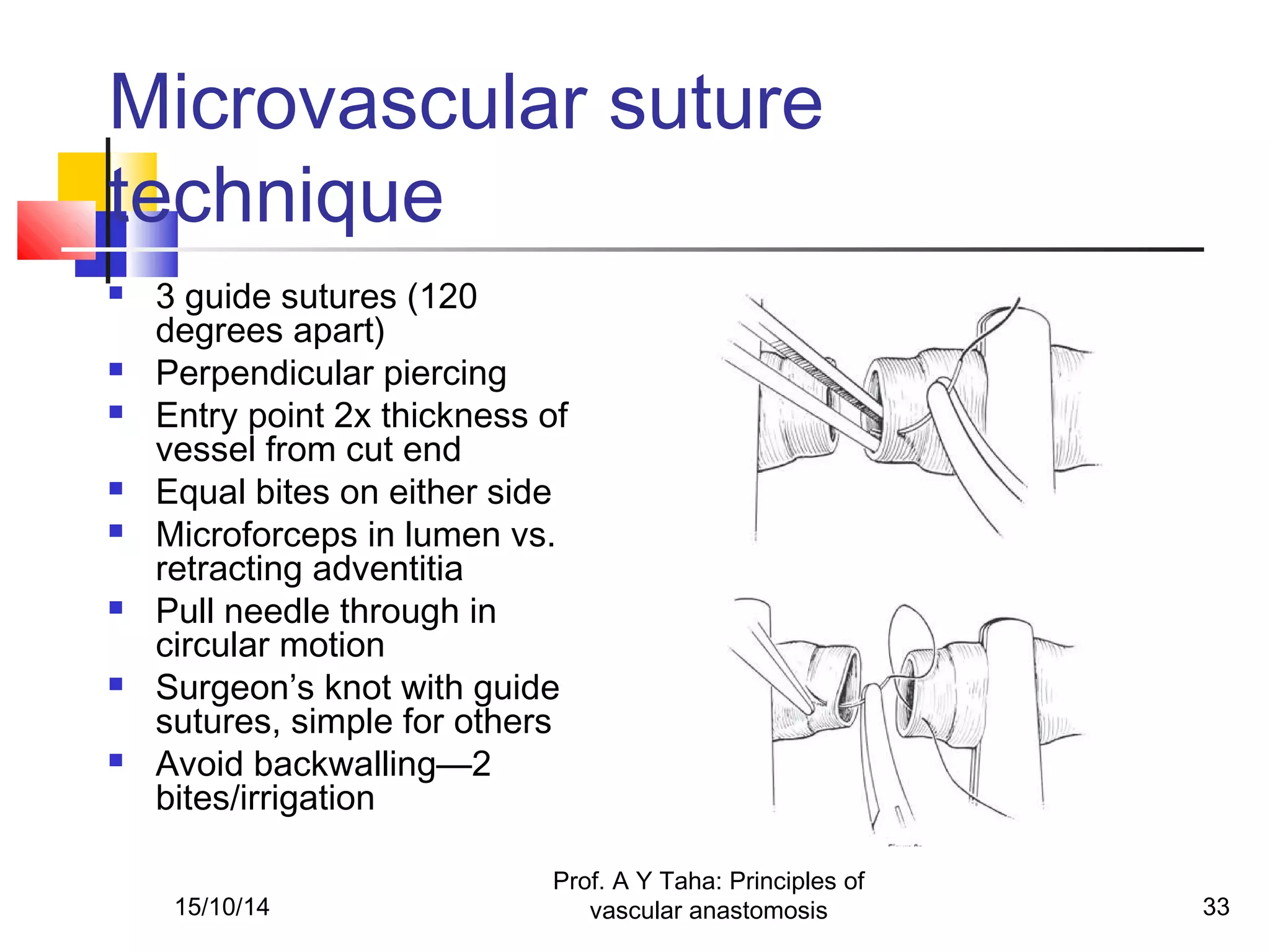 Principles of vascular anastomosis | PPT