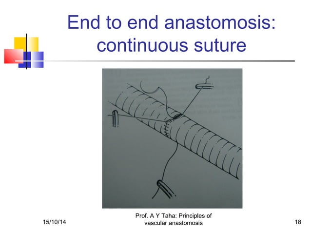 Principles of vascular anastomosis | PPT | First Aid | Injuries