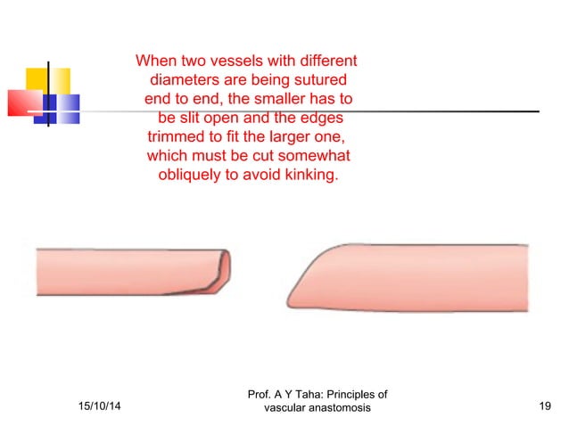 Principles of vascular anastomosis | PPT | First Aid | Injuries
