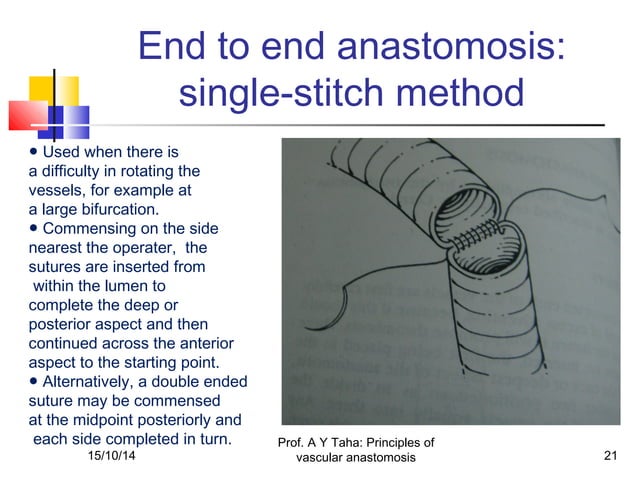 Principles of vascular anastomosis | PPT | First Aid | Injuries