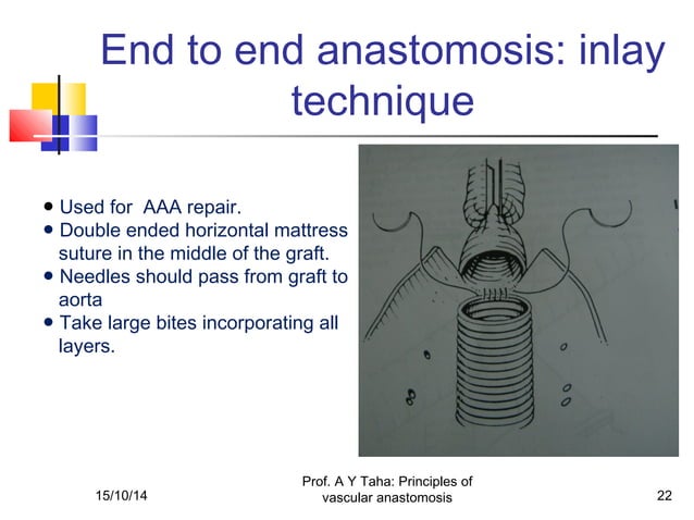 Principles of vascular anastomosis | PPT | First Aid | Injuries
