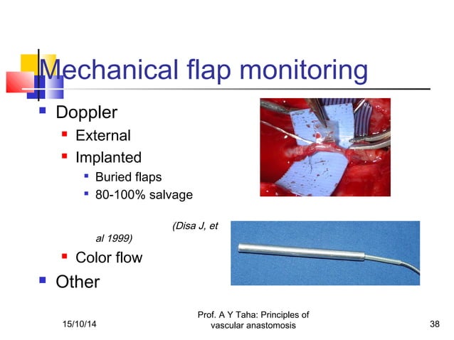 Principles of vascular anastomosis | PPT
