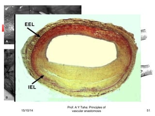 Principles of vascular anastomosis | PPT
