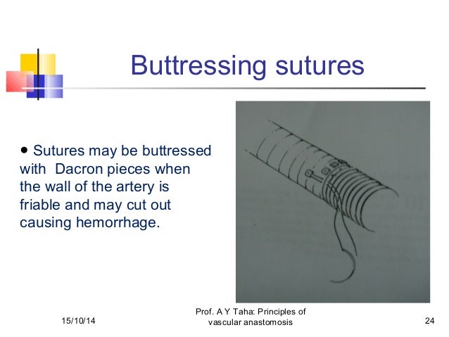 Principles of vascular anastomosis